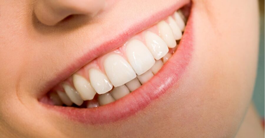 Buccal Corridors: Why Wider Smiles Are Attractive | SmileBar